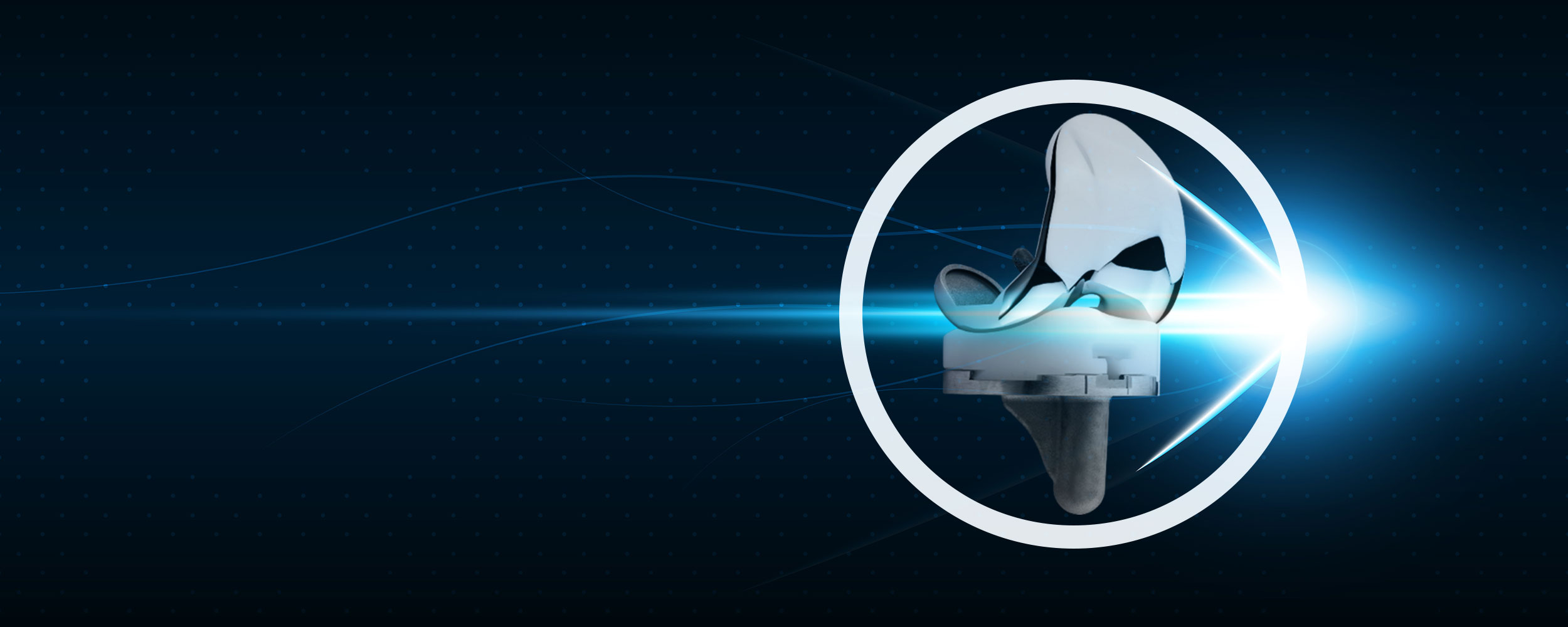 Medial-Pivot Knee ⋆ MyMPO™ • Full Function, Faster® • MicroPort ...