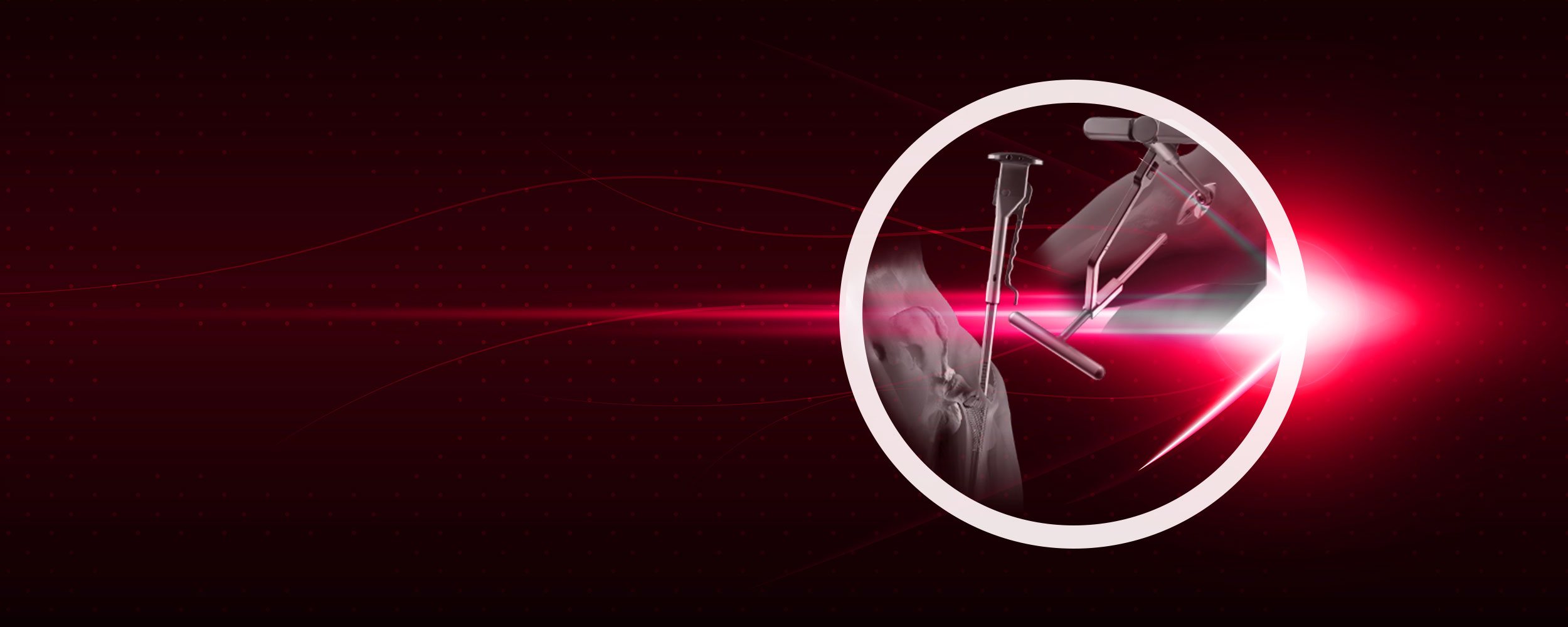 SuperPath® ⋆ MyMPO™ • Full Function, Faster® • MicroPort Orthopedics, Inc.